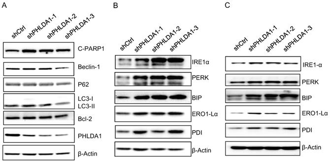 PHLDA1 Modulates the Endoplasmic Reticulum Stress Response and is ...