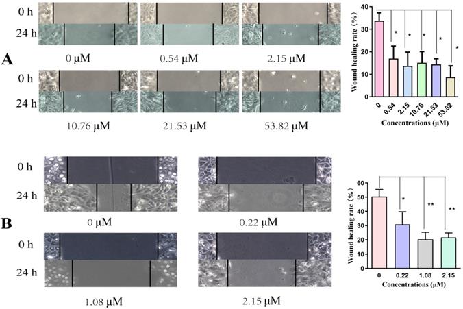 SNX-2112 Induces Apoptosis and Inhibits Proliferation, Invasion, and ...