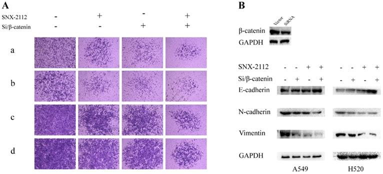 SNX-2112 Induces Apoptosis and Inhibits Proliferation, Invasion, and ...