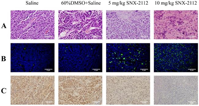 SNX-2112 Induces Apoptosis and Inhibits Proliferation, Invasion, and ...
