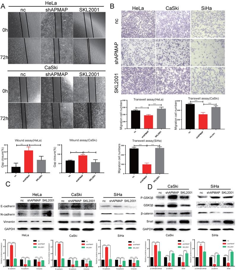 APMAP Promotes Epithelial-Mesenchymal Transition and Metastasis of ...
