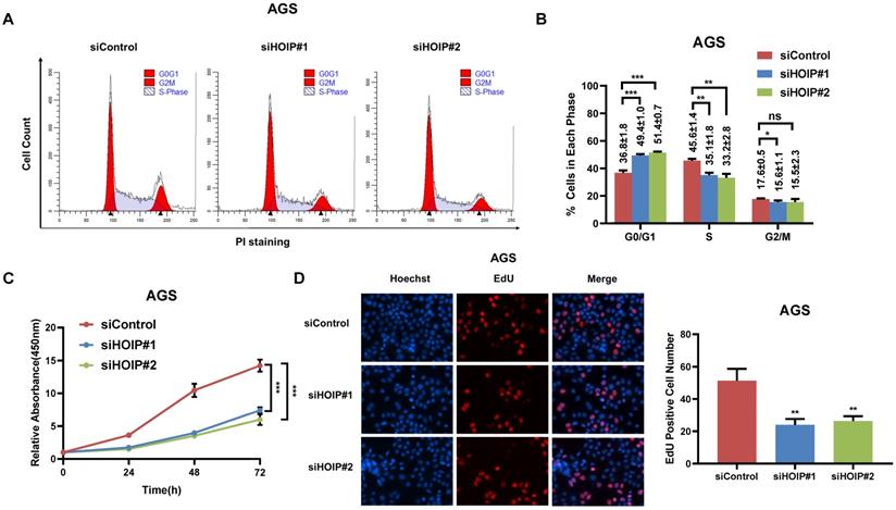 The E3 Ubiquitin Ligase HOIP inhibits Cancer Cell Apoptosis via ...