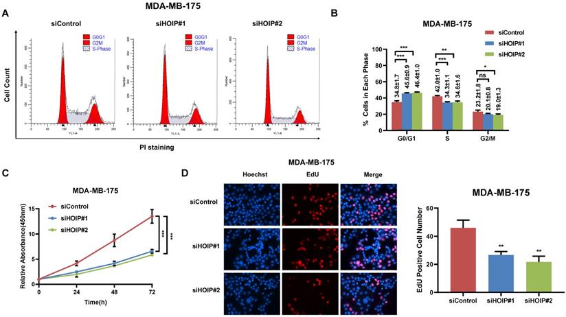 The E3 Ubiquitin Ligase HOIP inhibits Cancer Cell Apoptosis via ...