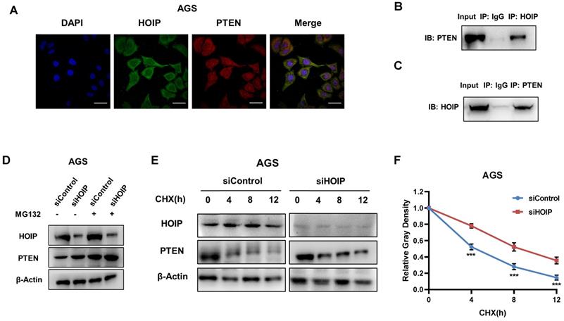 The E3 Ubiquitin Ligase HOIP inhibits Cancer Cell Apoptosis via ...