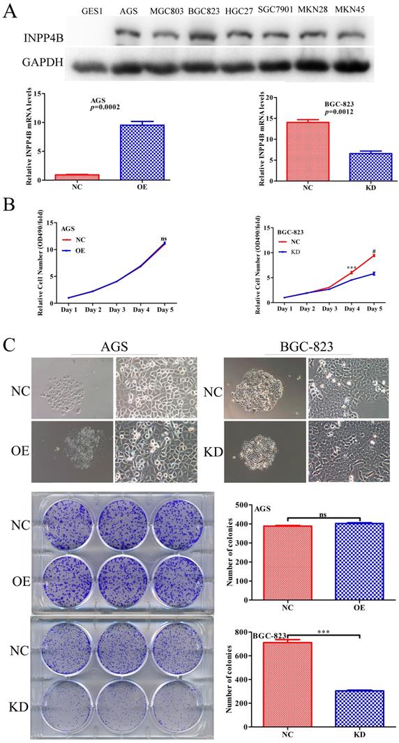 INPP4B exerts a dual role in gastric cancer progression and prognosis