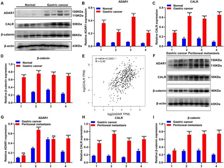 Targeting ADAR1 suppresses progression and peritoneal metastasis of ...