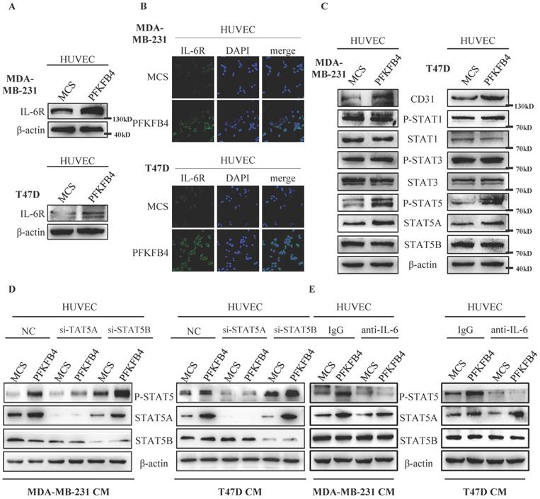 PFKFB4 promotes angiogenesis via IL-6/STAT5A/P-STAT5 signaling in ...