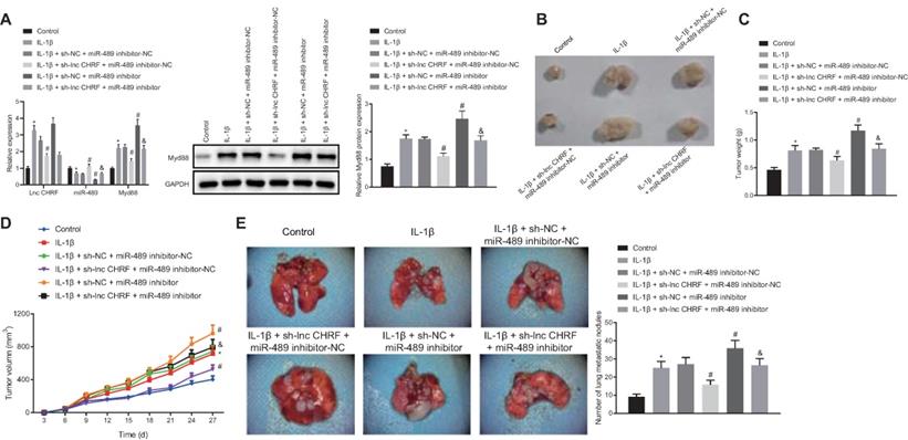 IL-1β-Triggered Long Non-coding RNA CHRF Induces Non-Small Cell Lung ...