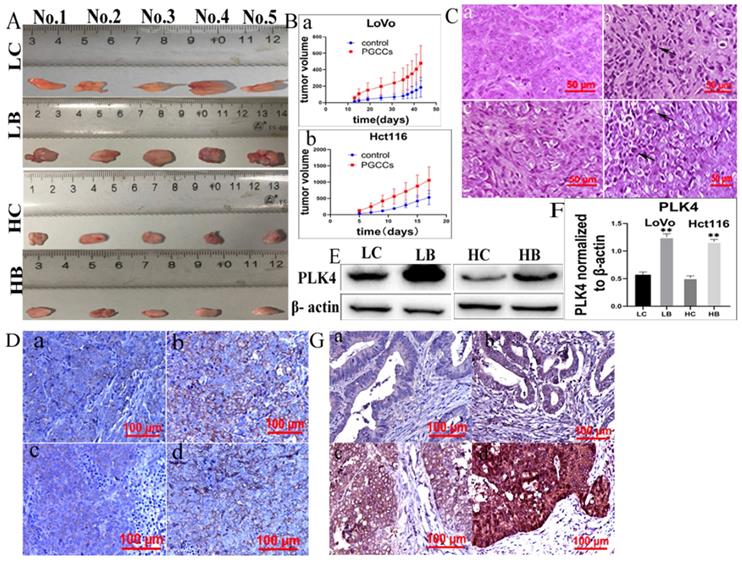 PLK4 is a key molecule in the formation of PGCCs and promotes invasion ...