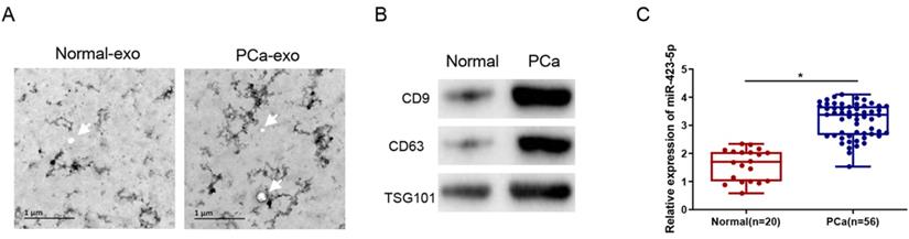 Blood circulating exosomes carrying microRNA-423-5p regulates cell ...