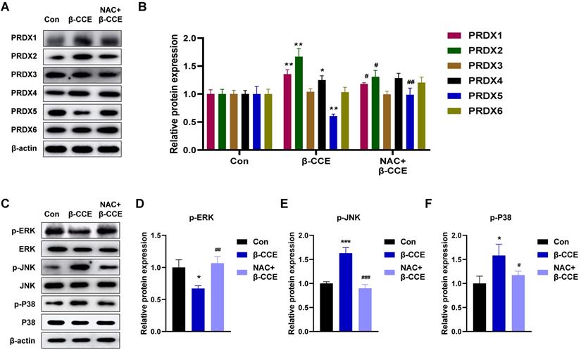 Peroxiredoxin 5 protects HepG2 cells from ethyl β-carboline-3-carboxylate-induced cell death via ...