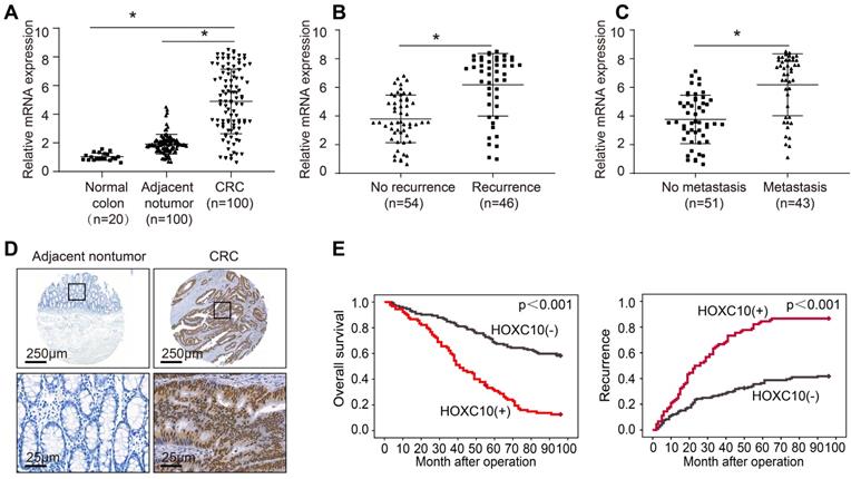 HOXC10 Promotes Metastasis in Colorectal Cancer by Recruiting Myeloid ...