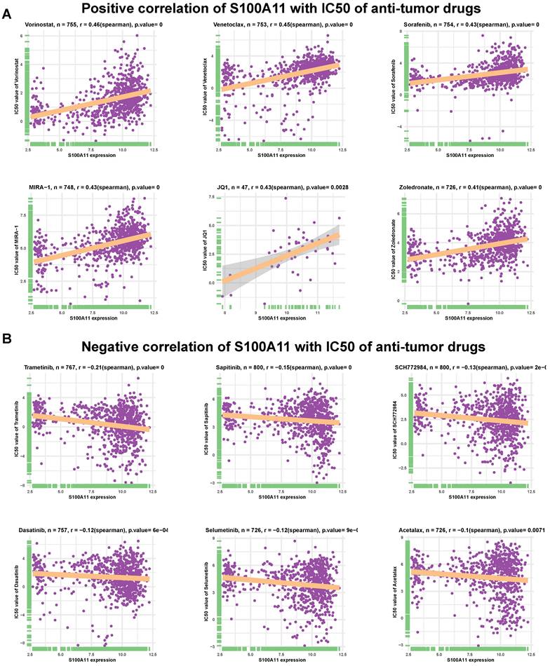 S100A11: A Potential Carcinogen and Prognostic Marker That Correlates ...