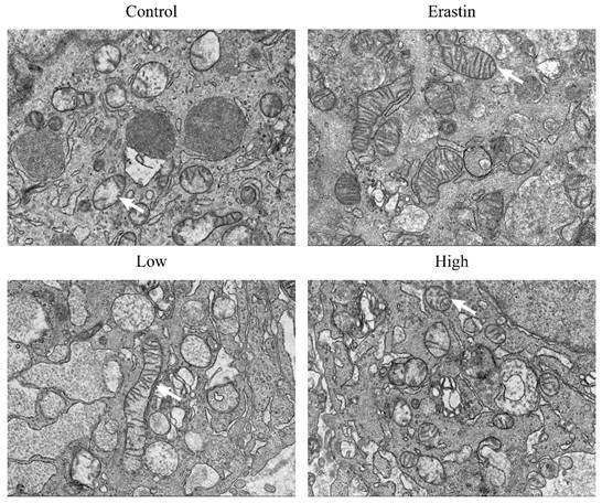 Inhibition of Non-small Cell Lung Cancer by Ferroptosis and Apoptosis ...