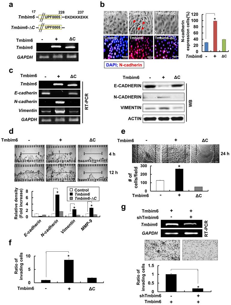 TMBIM6-mediated miR-181a expression regulates breast cancer cell ...