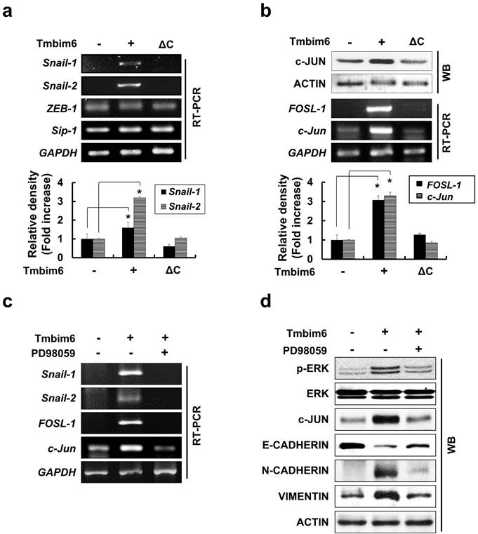 TMBIM6-mediated miR-181a expression regulates breast cancer cell ...