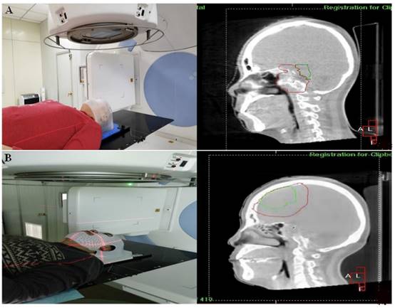 Study on the application of 3D printing head film fixation technology ...
