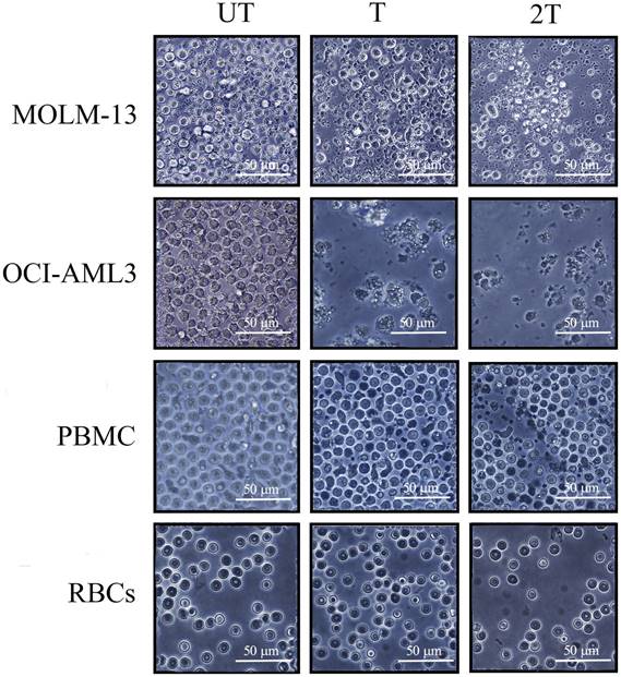In Vitro Effects of Low-energy Ultrasound Treatment on Healthy CD3/CD8 ...
