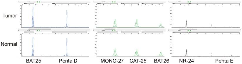 Microsatellite Status Detection of Colorectal Cancer: Evaluation of ...