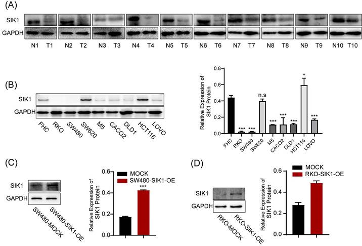 SIK1 suppresses colorectal cancer metastasis and chemoresistance via ...