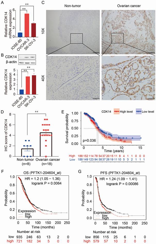 Cyclin dependent kinase 14 as a paclitaxel-resistant marker regulated by the TGF-β signaling ...