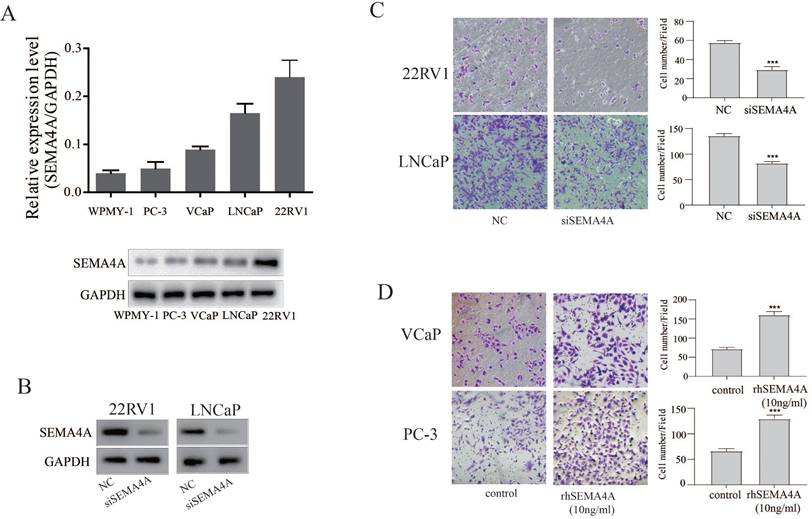 SEMA4A promotes prostate cancer invasion: involvement of tumor ...