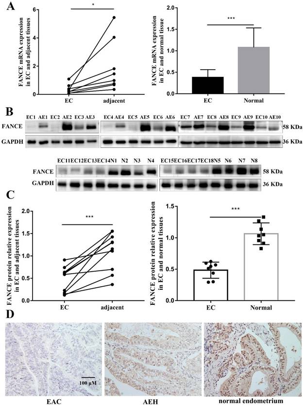 Reduced FANCE Confers Genomic Instability and Malignant Behavior by ...