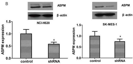 Abnormal spindle-like microcephaly-associated protein (ASPM ...