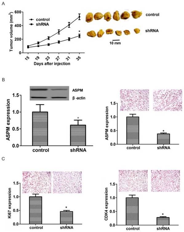 Abnormal spindle-like microcephaly-associated protein (ASPM ...