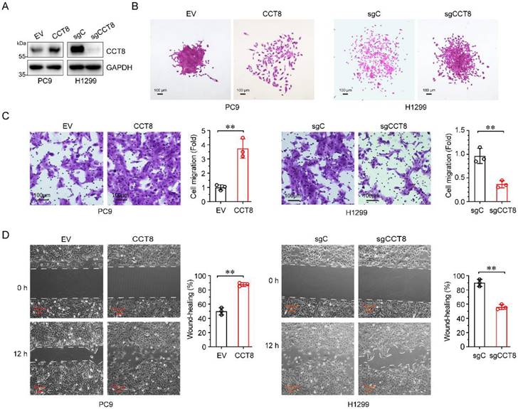 CCT8 promotes cell migration and tumor metastasis in lung adenocarcinomas