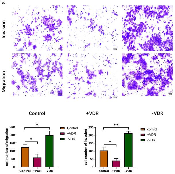 Molecular Mechanism of Vitamin D Receptor Modulating Wnt/β-catenin ...