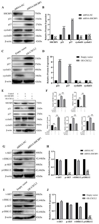 SHCBP1 Promotes the Proliferation of Breast Cancer Cells by Inhibiting ...